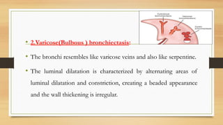 Bronchiectasis.pptx, definition, causes and risk factors, signs and ...