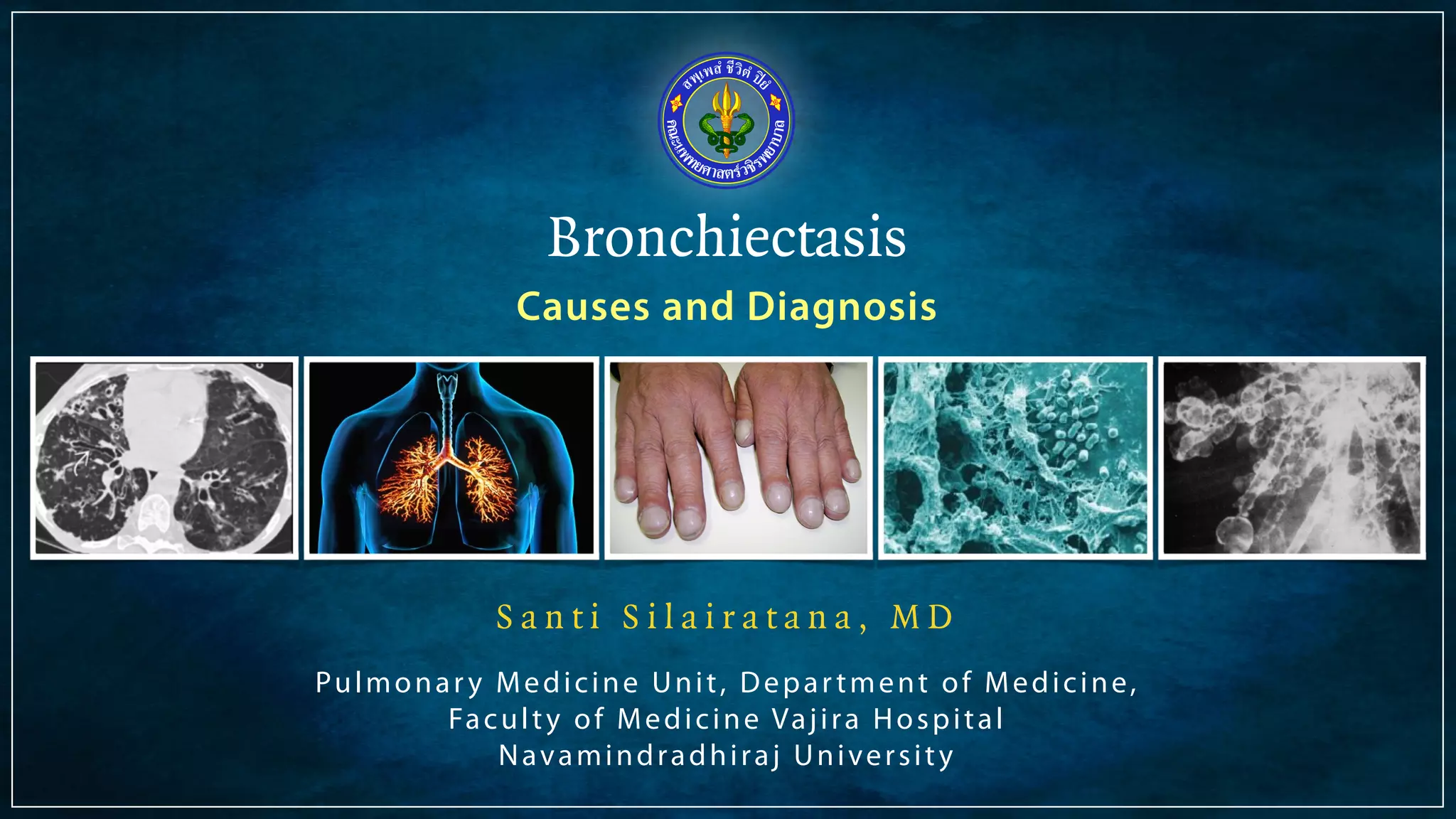 Bronchiectasis - causes and diagnosis | PDF