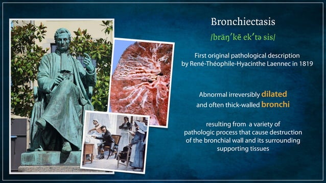 Bronchiectasis - causes and diagnosis | PDF
