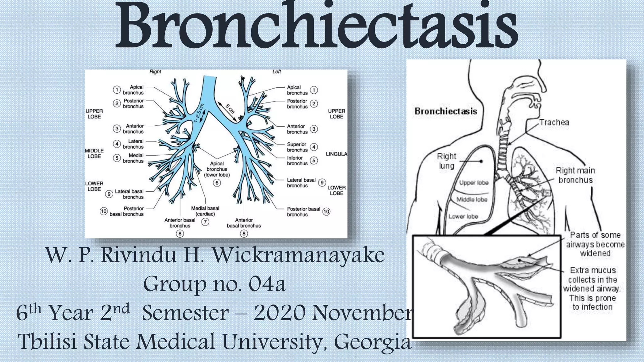 Bronchiectasis | PPTX