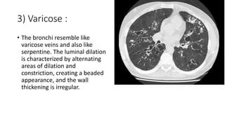 Bronchiectasis | PPT