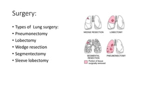Bronchiectasis | PPT