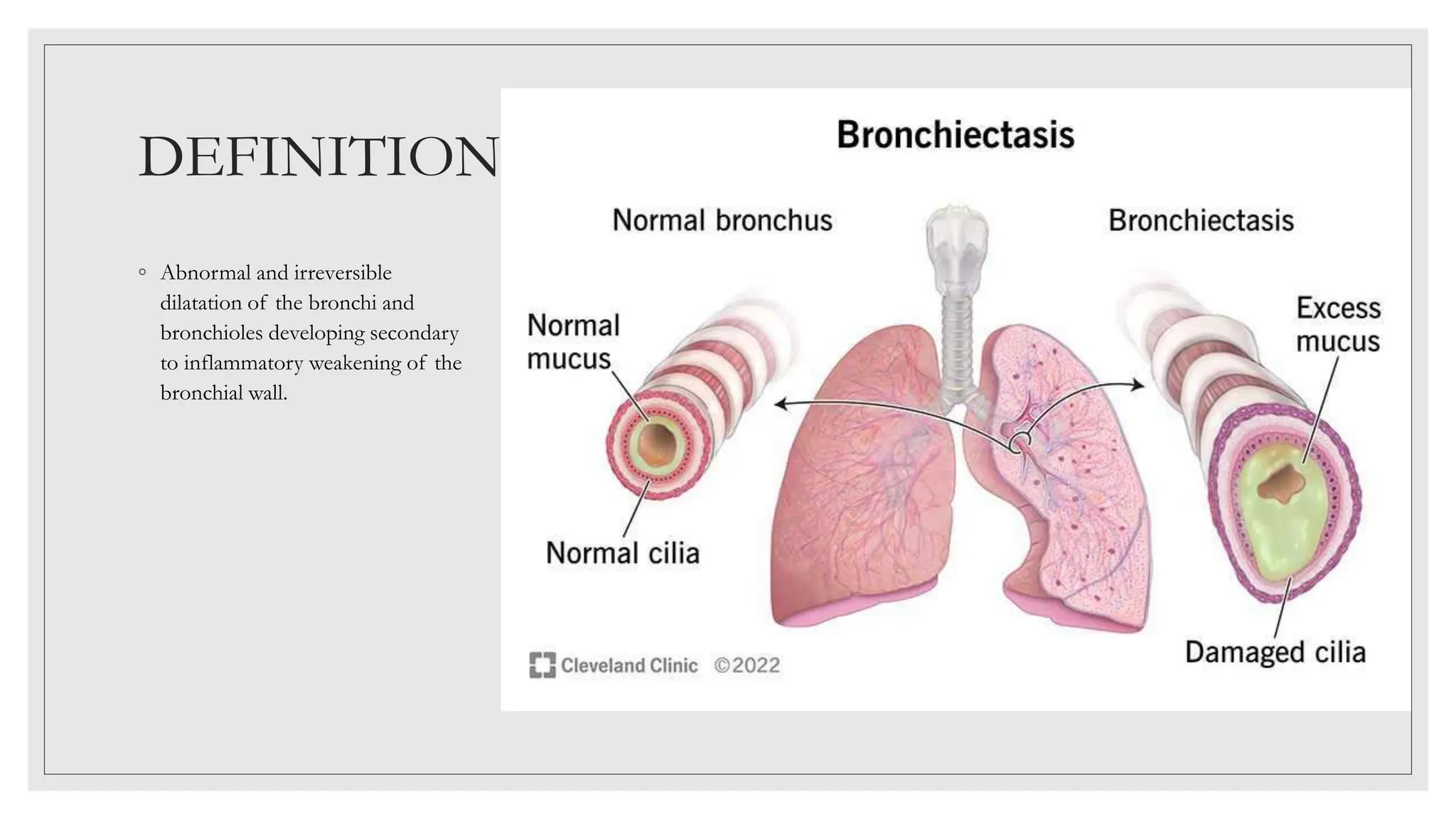 BRONCHIECTASIS PATHOLOGY FOR NURSES.pptx