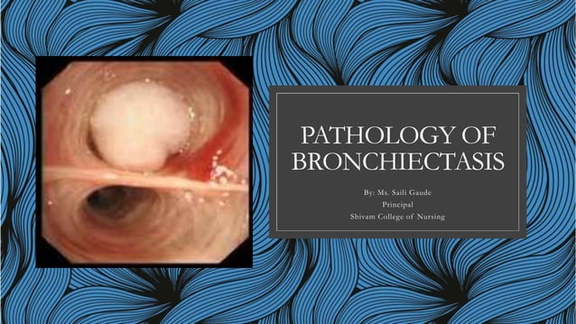 BRONCHIECTASIS PATHOLOGY FOR NURSES.pptx | Lung and Respiratory Health ...