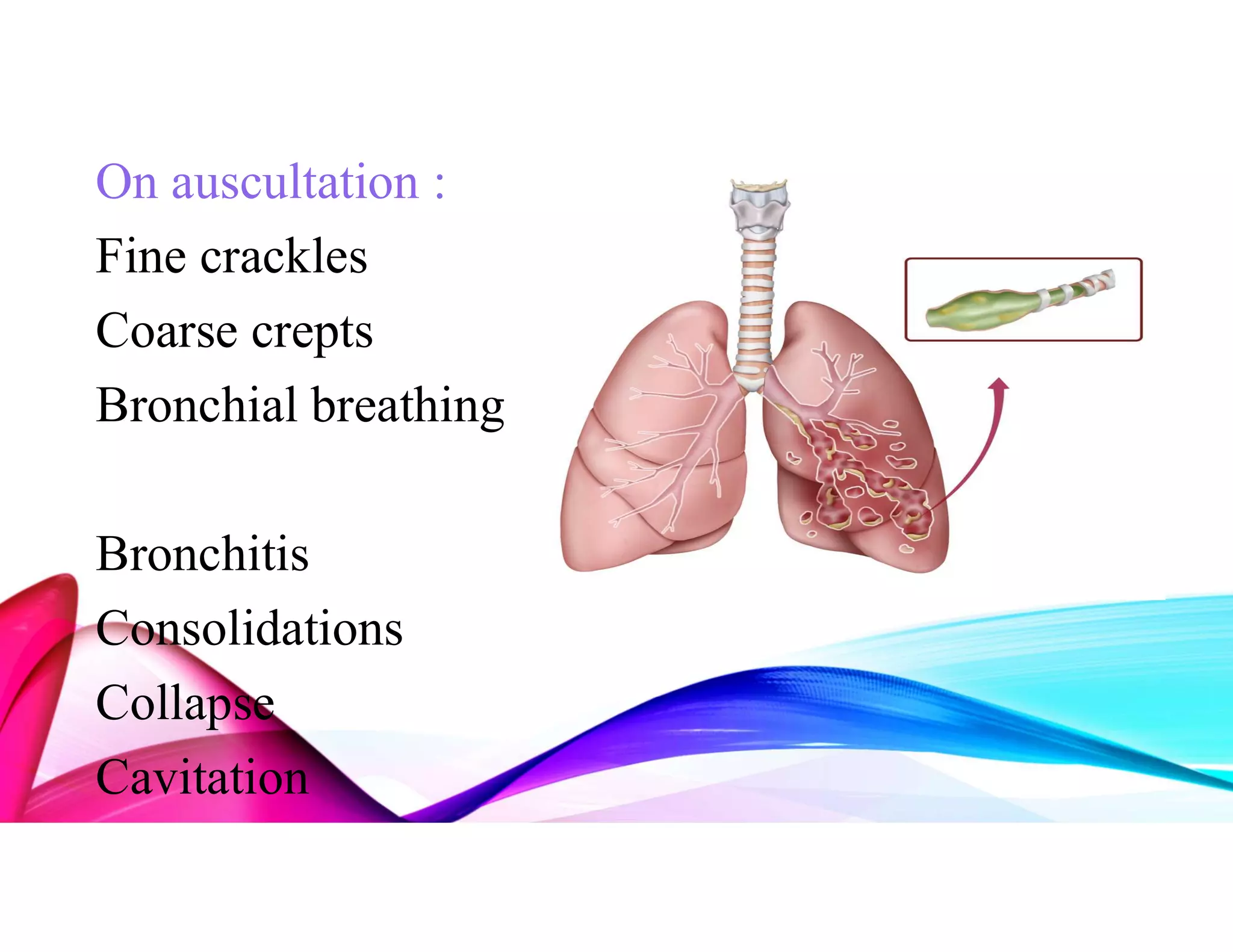 BRONCHIECTASIS PPT .pdf