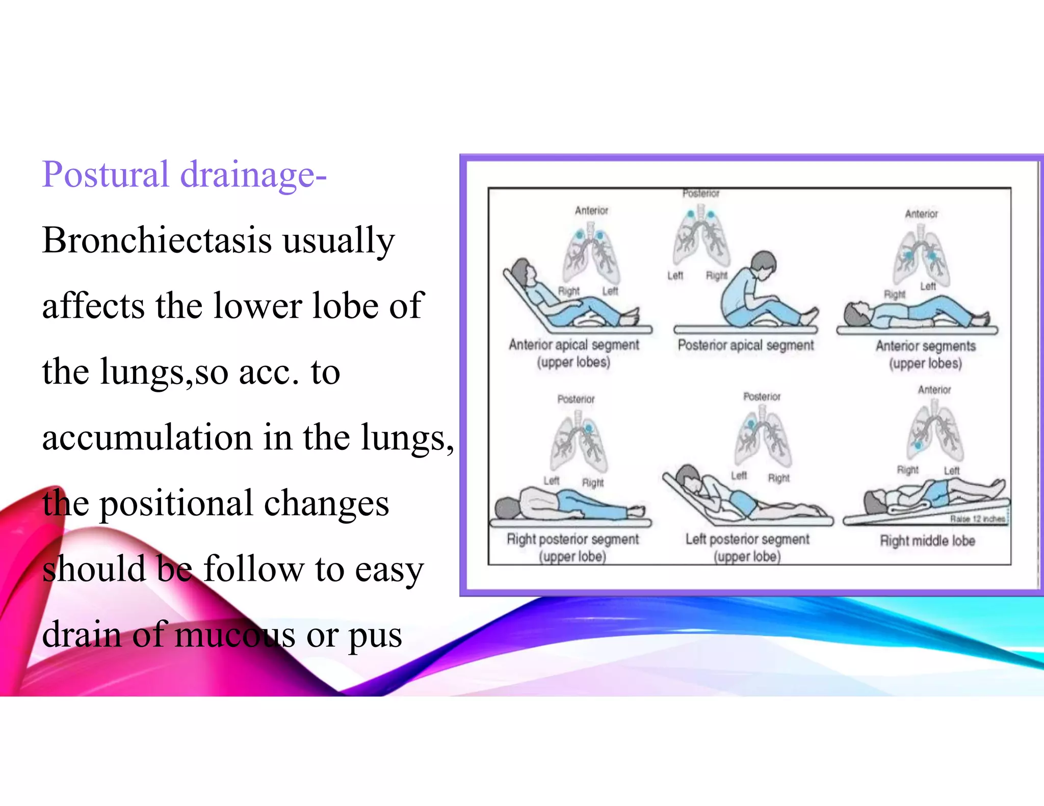 BRONCHIECTASIS PPT .pdf