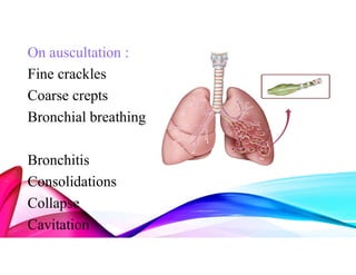 BRONCHIECTASIS PPT .pdf