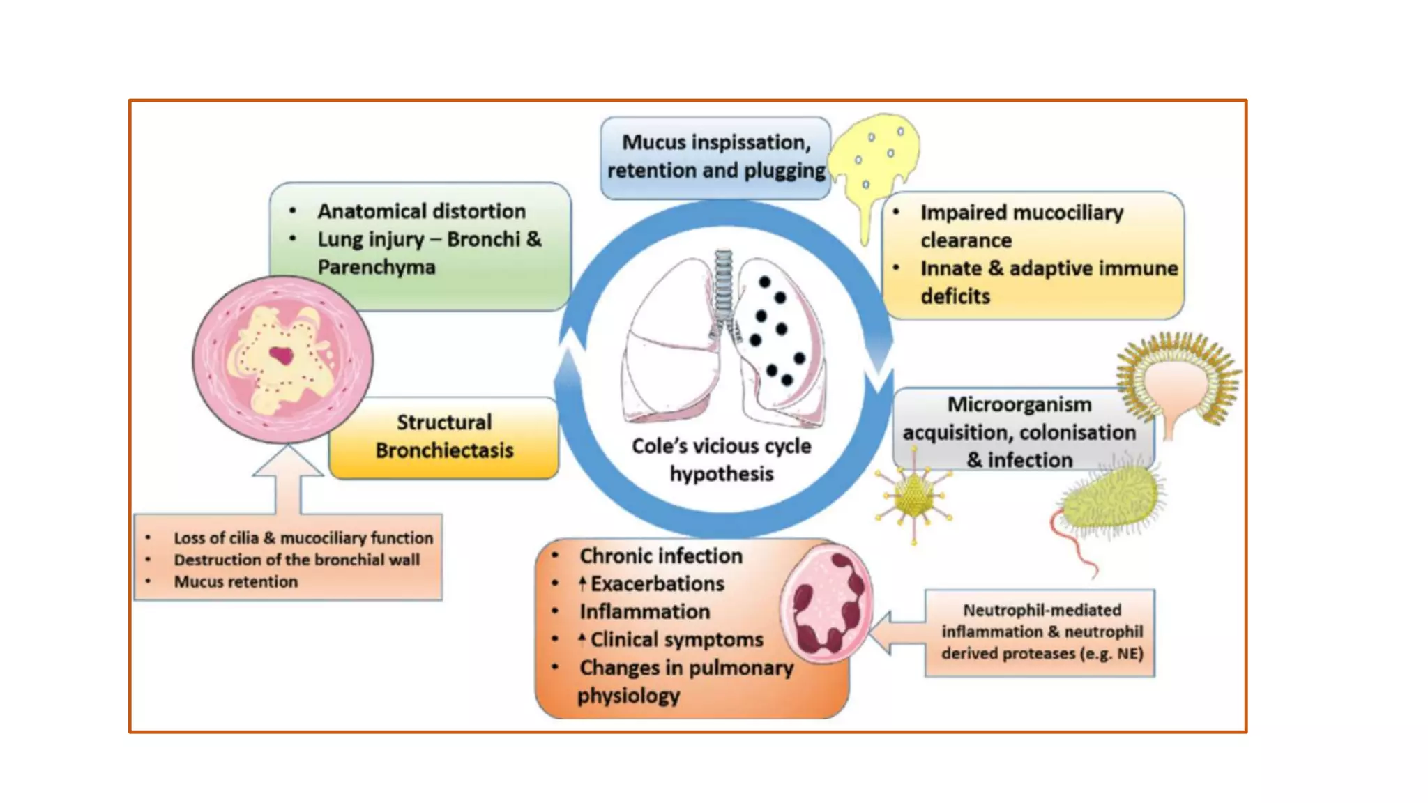 Bronchiectasis and Role of Surgical Management.pptx