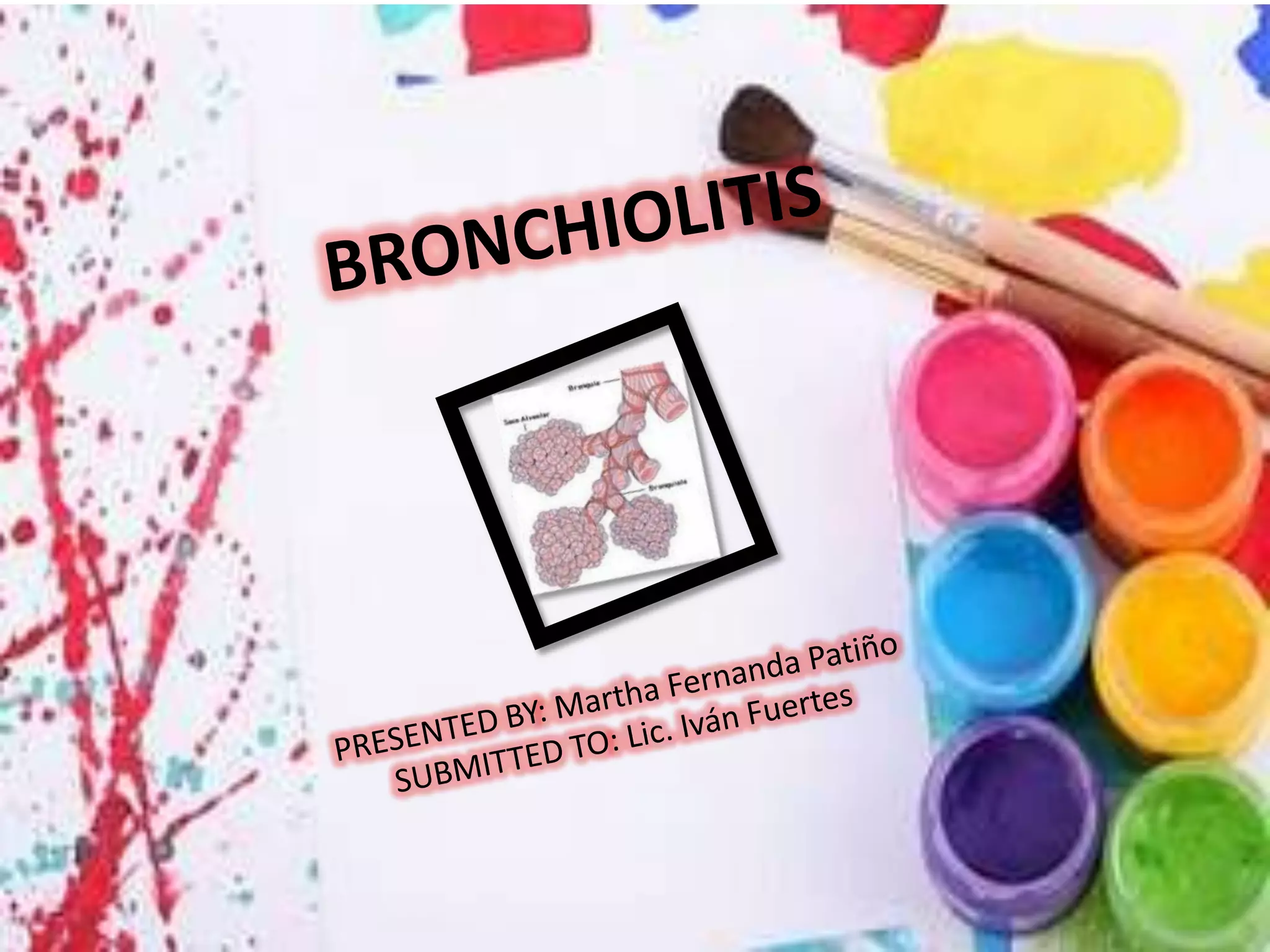 Bronchiolitis | PPTX