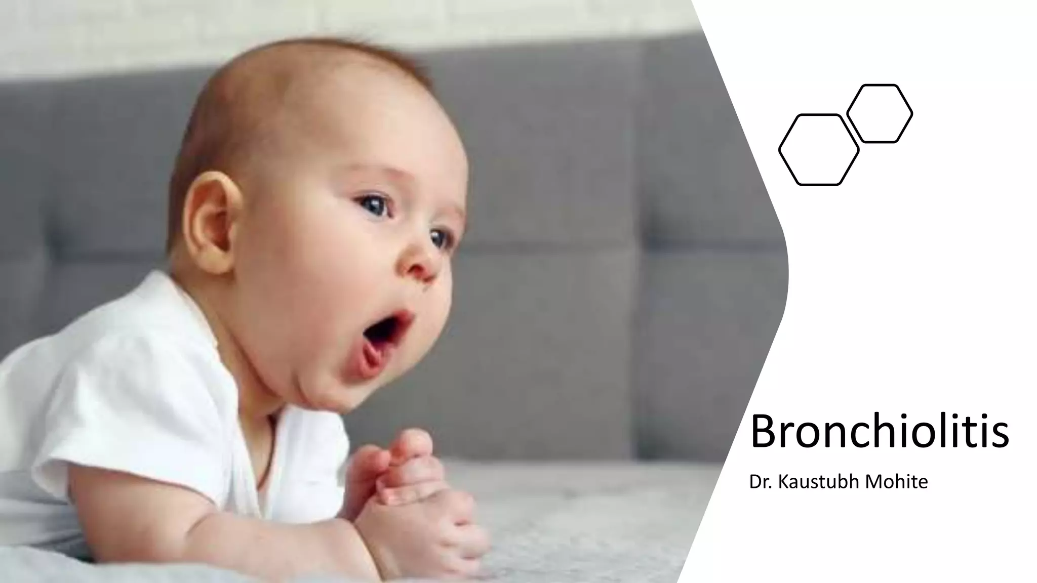Bronchiolitis | PPT