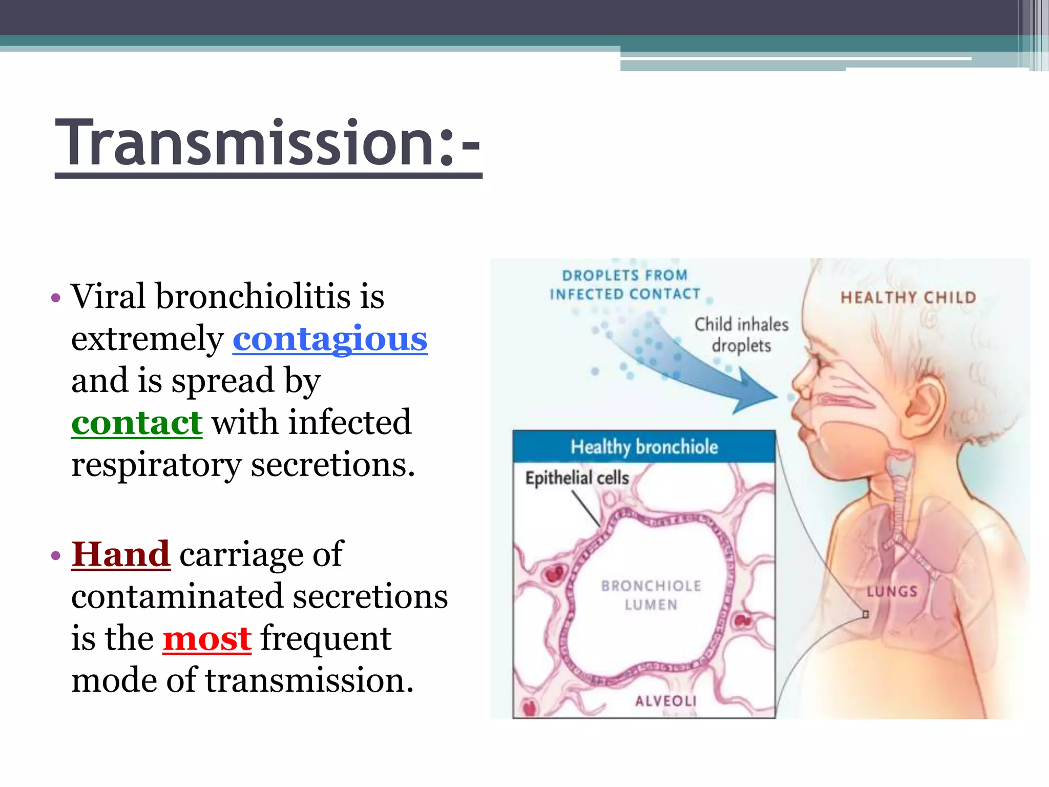 Bronchiolitis.pptx