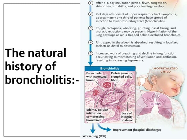 Bronchiolitis.pptx