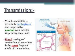 Bronchiolitis.pptx