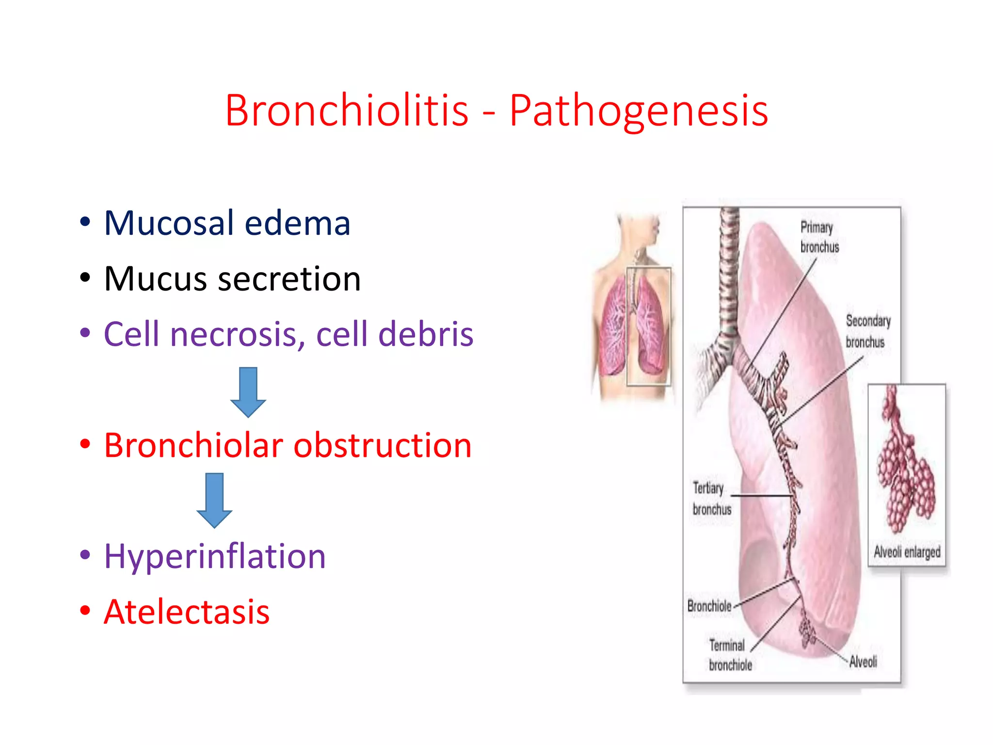 Bronchiolitis 2021 | PDF