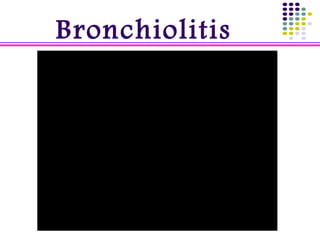 Bronchiolitis, croup | PPT