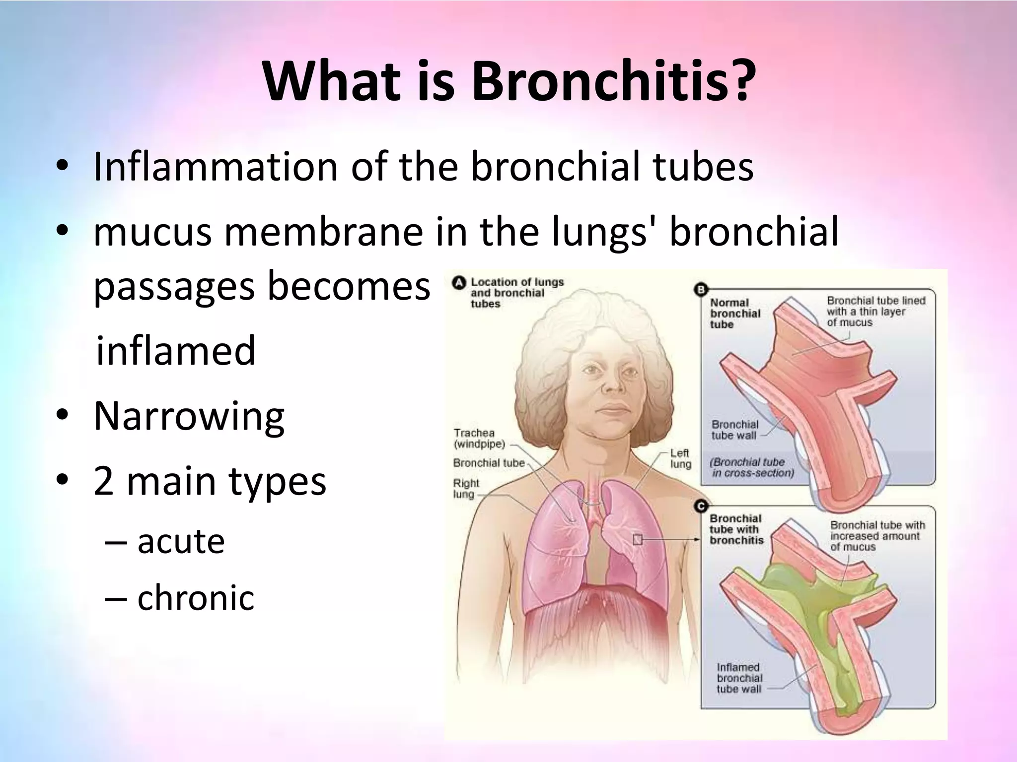 Bronchitis Disease | PPTX | Lung and Respiratory Health | Diseases and ...