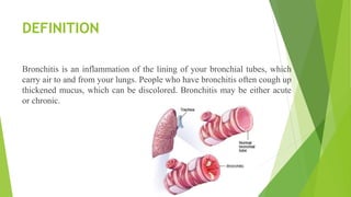 Bronchitis | PPTX