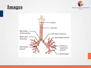 bronchitis case in radiology.pptx