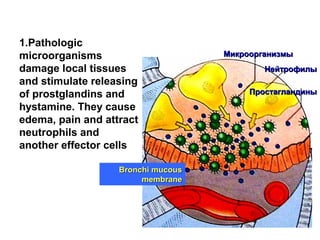 Bronchitis lecture in children | PPT