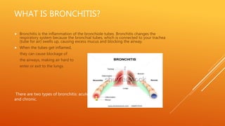Bronchitis powerpoint | PPTX