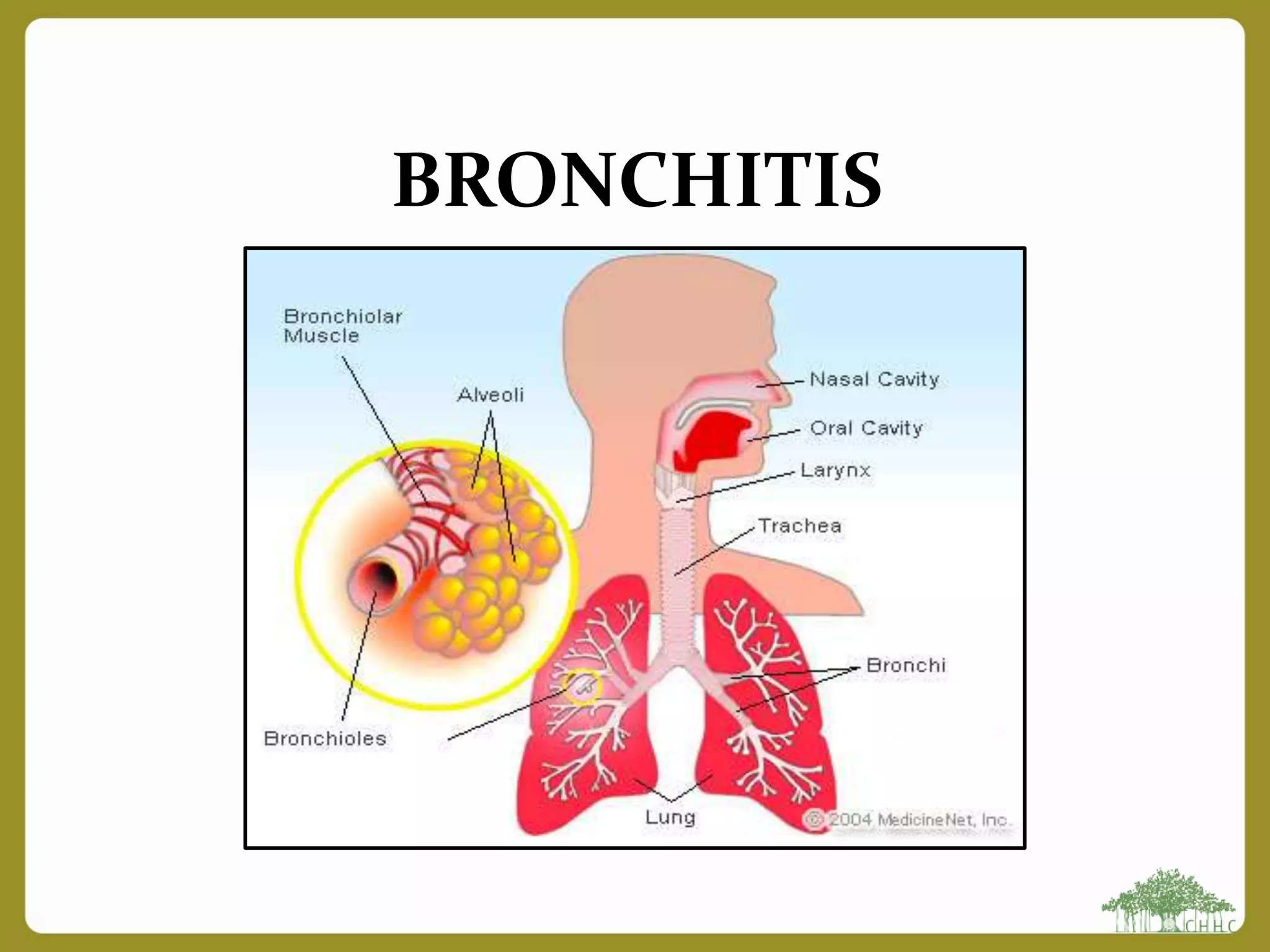 Bronchitis ppt | PPTX