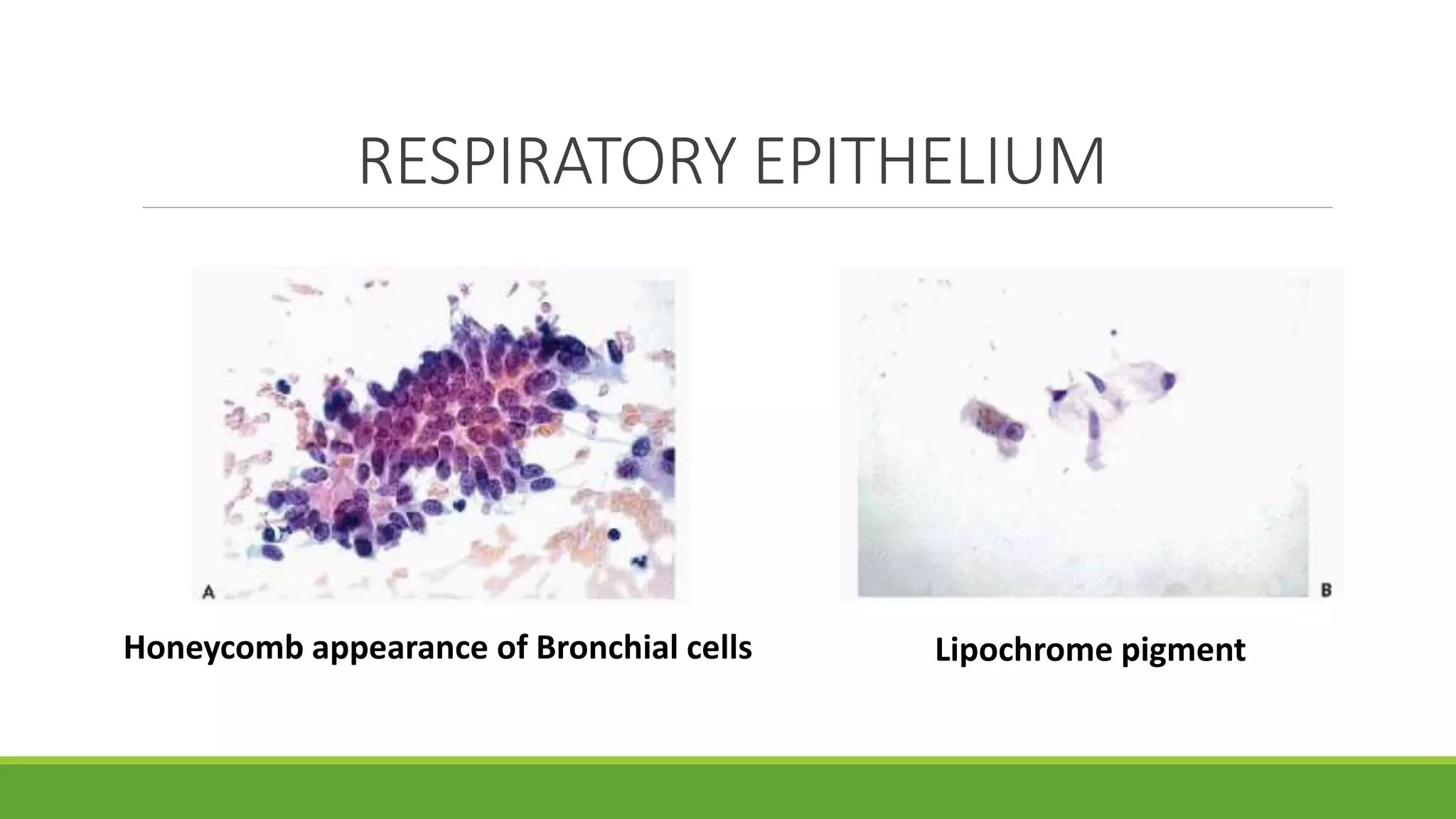 BRONCHOALVEOLAR CYTOLOGY.pptx