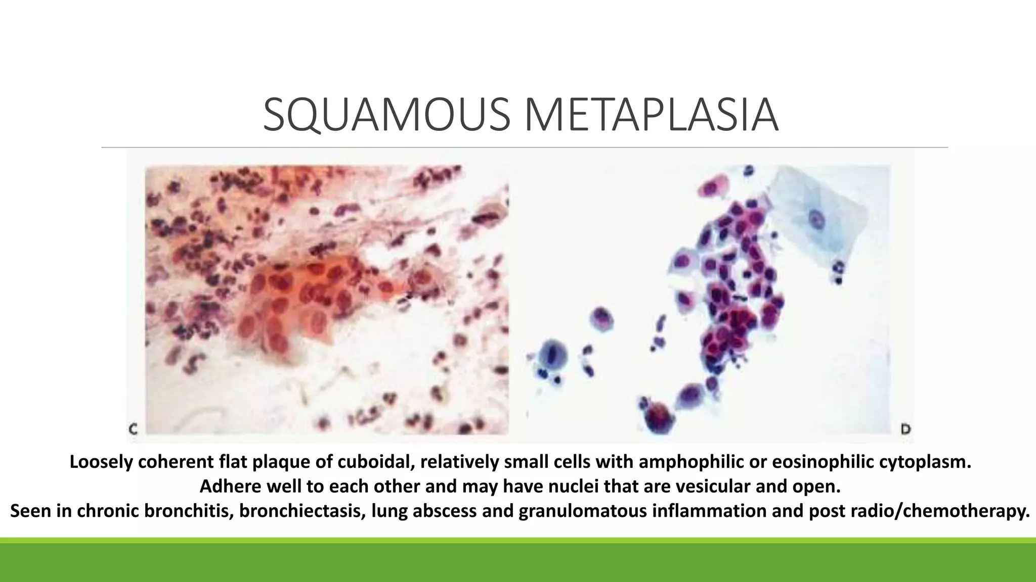 BRONCHOALVEOLAR CYTOLOGY.pptx