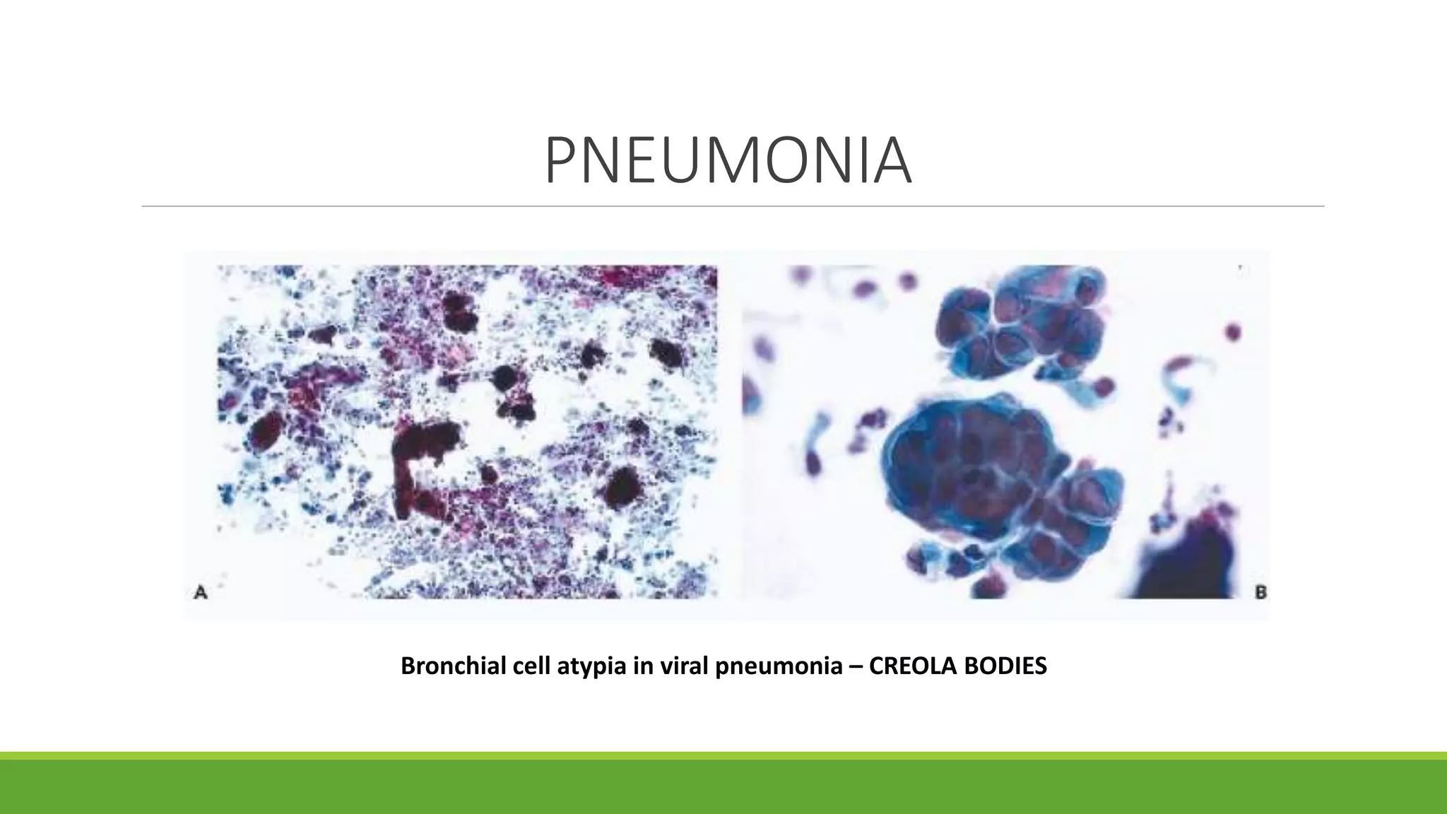 BRONCHOALVEOLAR CYTOLOGY.pptx