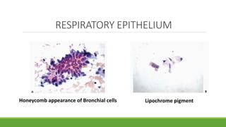 BRONCHOALVEOLAR CYTOLOGY.pptx