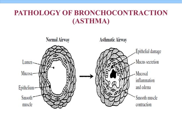 Bronchodilators | ODP | Lung and Respiratory Health | Diseases and ...