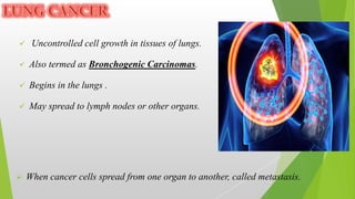 Bronchogenic Carcinoma - Lung Cancer | PPT