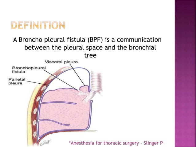 Bronchopleural fistula anesthetic concerns | PPT