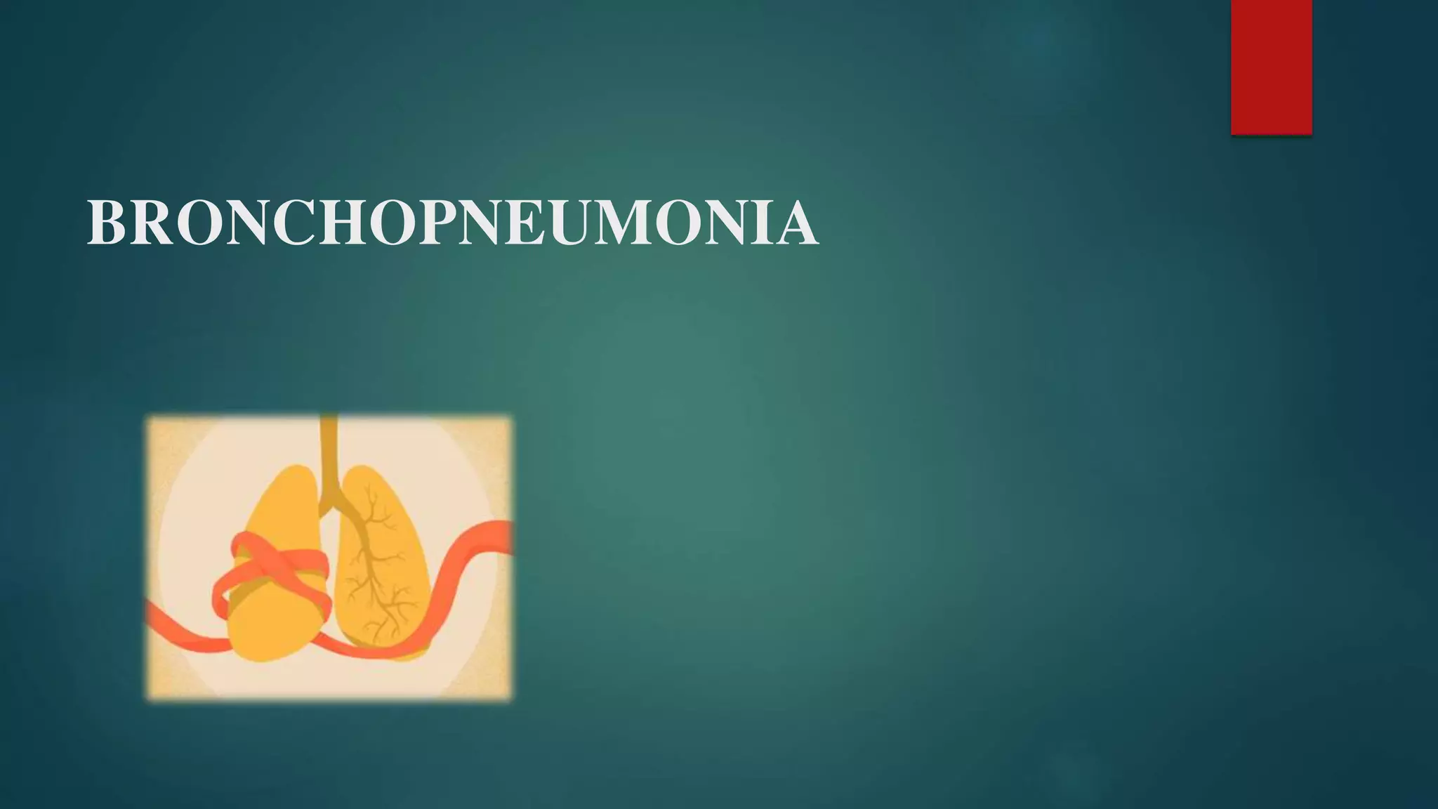 Bronchopneumonia | PPTX