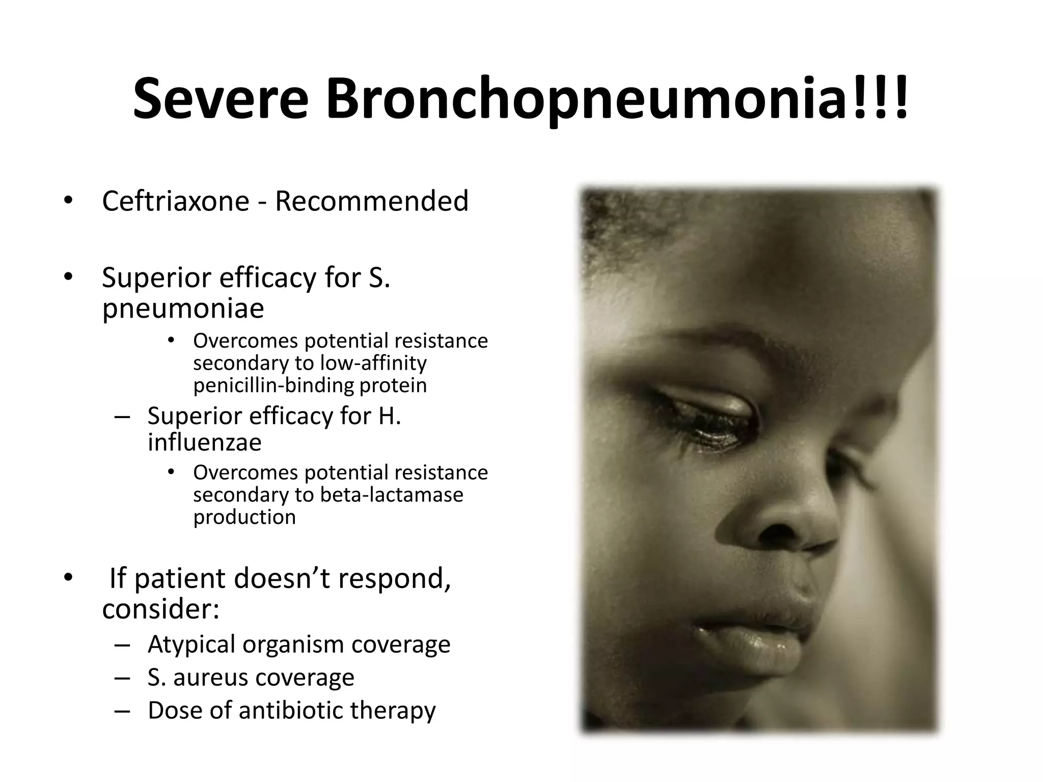Bronchopnuemonia | PPTX
