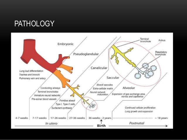 Bronchopulmonary dysplasia
