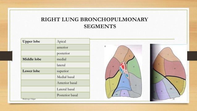 Bronchopulmonary segments | PPTX