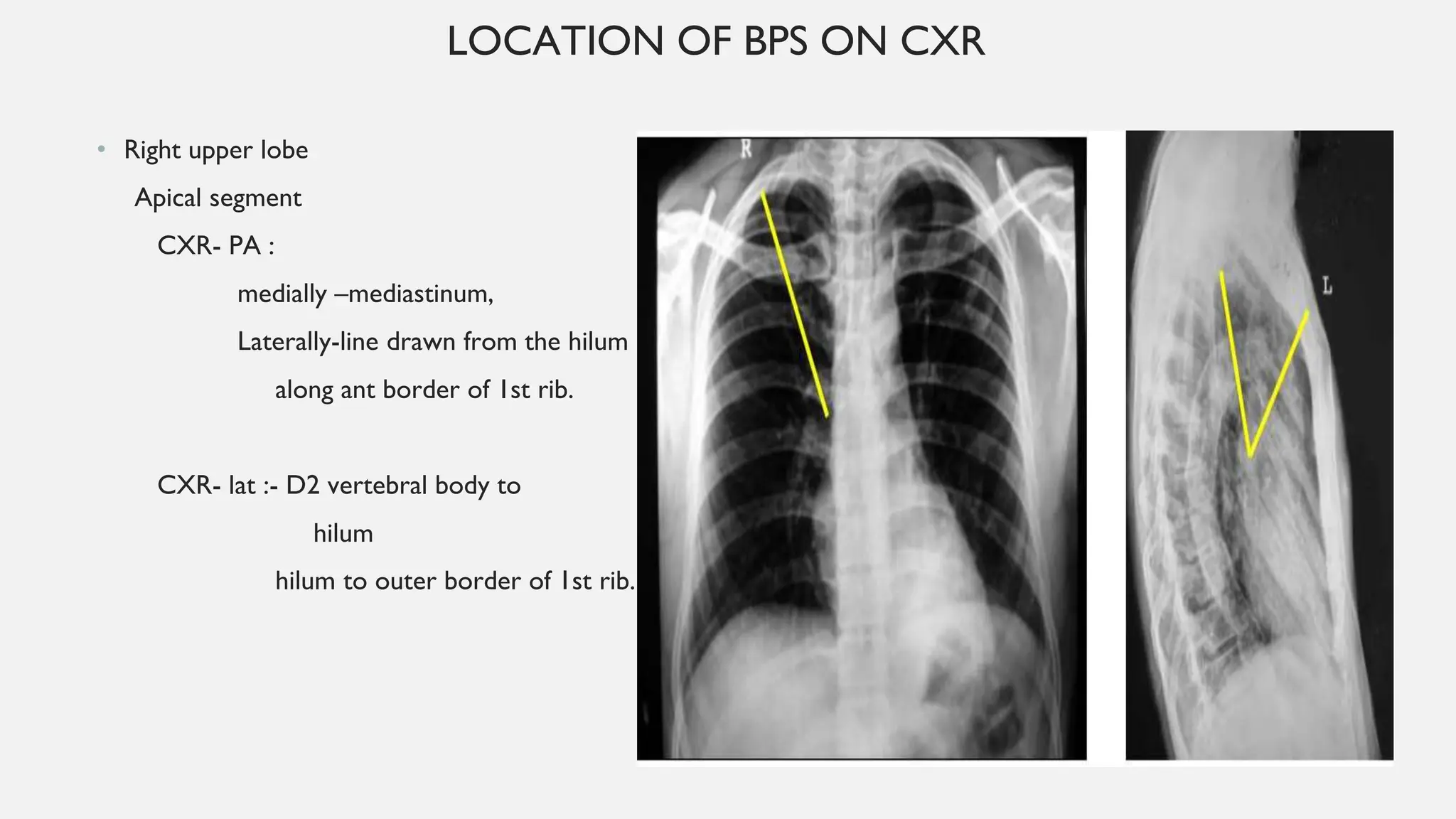 BRONCHOPULMONARY SEGMENTS RADIOLOGY AND IMAGING | PPTX