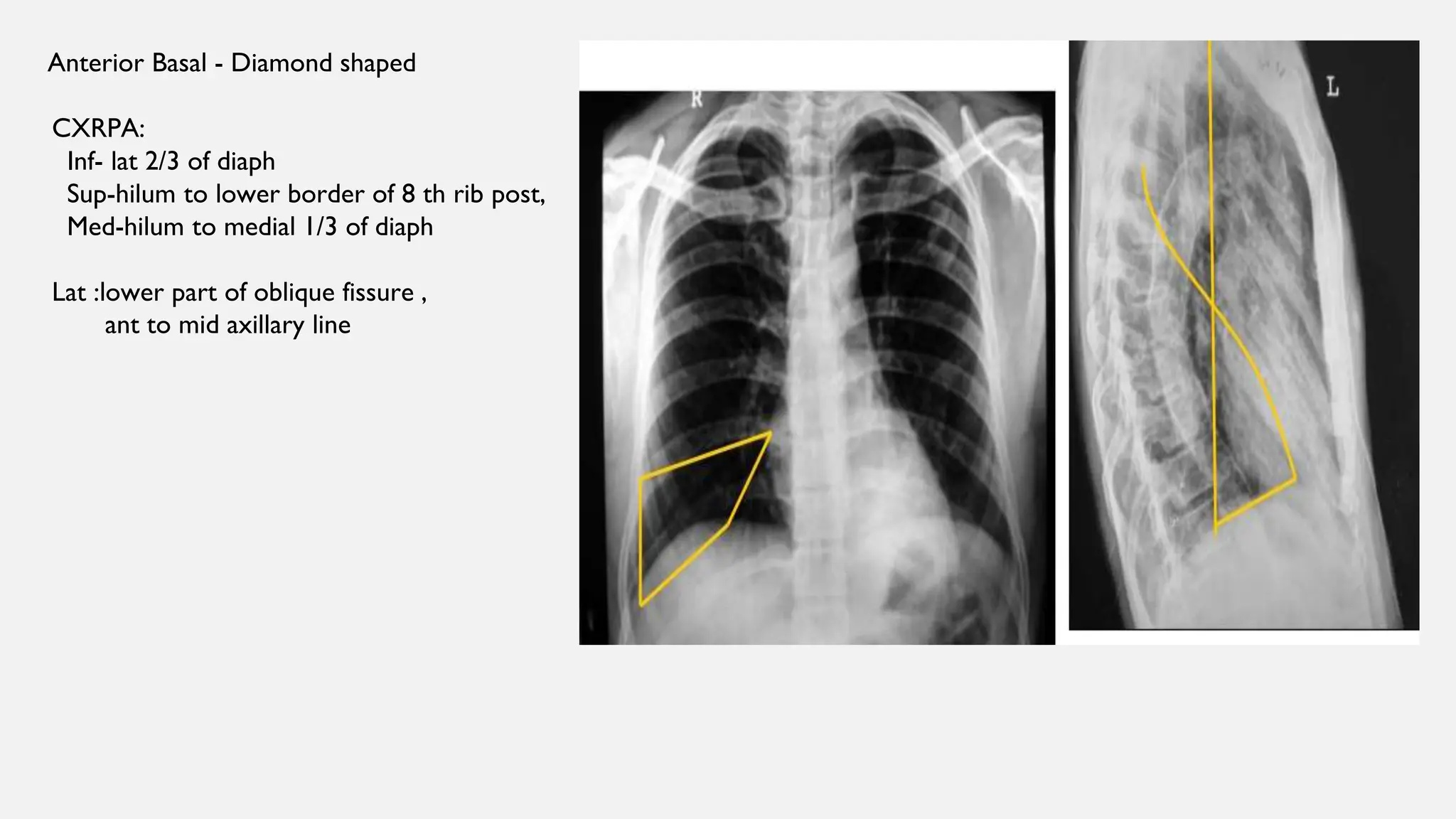BRONCHOPULMONARY SEGMENTS RADIOLOGY AND IMAGING | PPTX