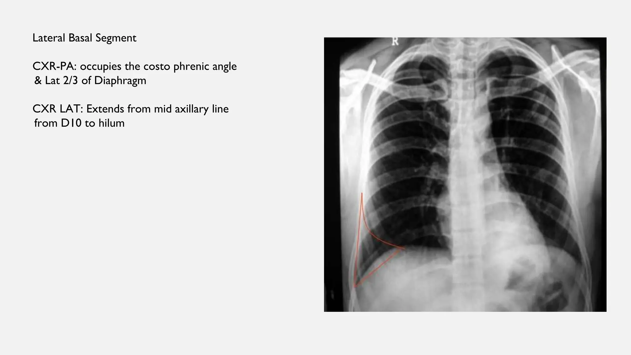 BRONCHOPULMONARY SEGMENTS RADIOLOGY AND IMAGING | PPTX