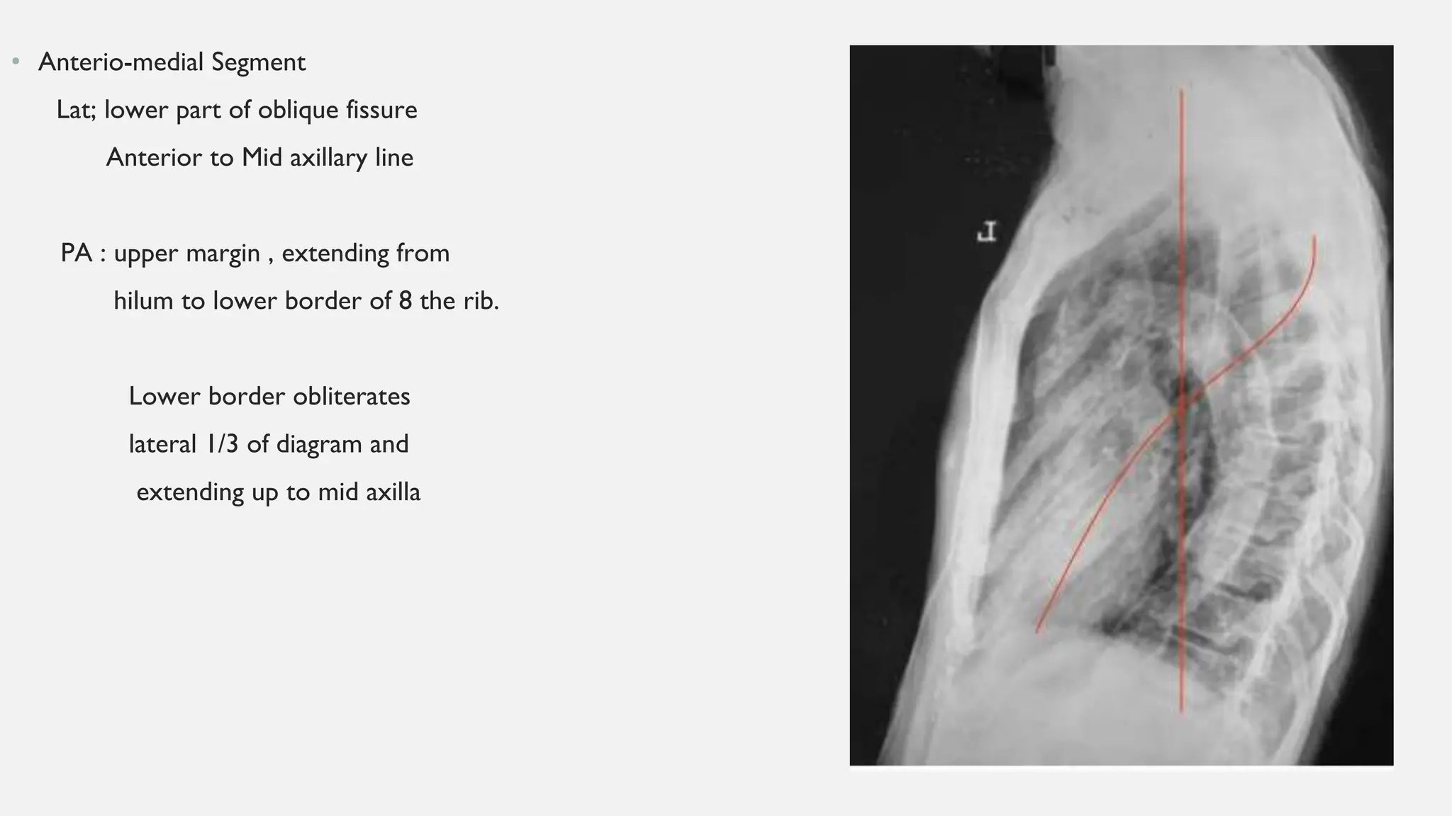 BRONCHOPULMONARY SEGMENTS RADIOLOGY AND IMAGING | PPTX