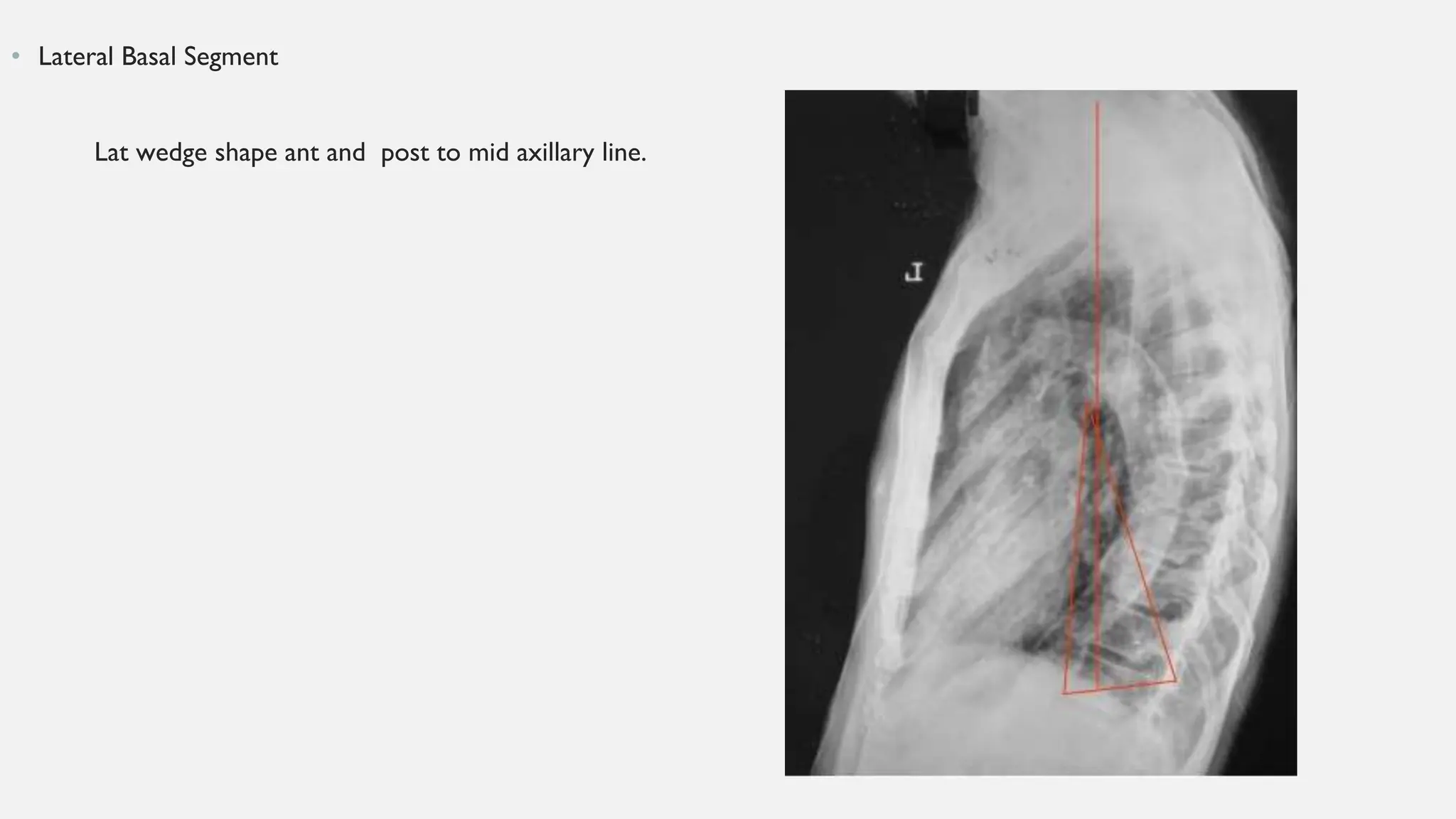 BRONCHOPULMONARY SEGMENTS RADIOLOGY AND IMAGING | PPTX
