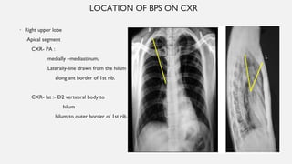 BRONCHOPULMONARY SEGMENTS RADIOLOGY AND IMAGING | PPTX