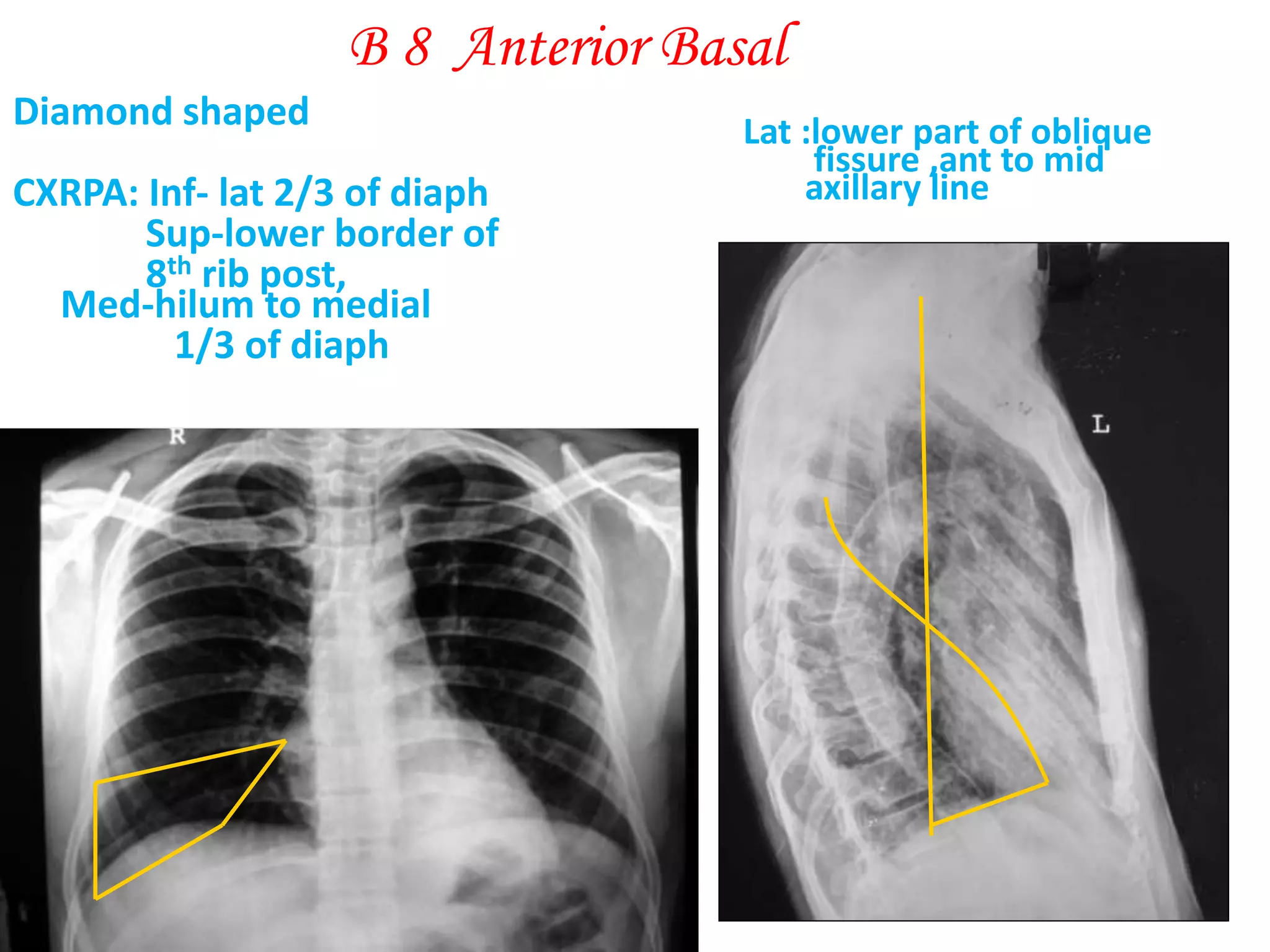 BRONCHOPULMONARY SEGMENTS OF THE LUNG | PPTX