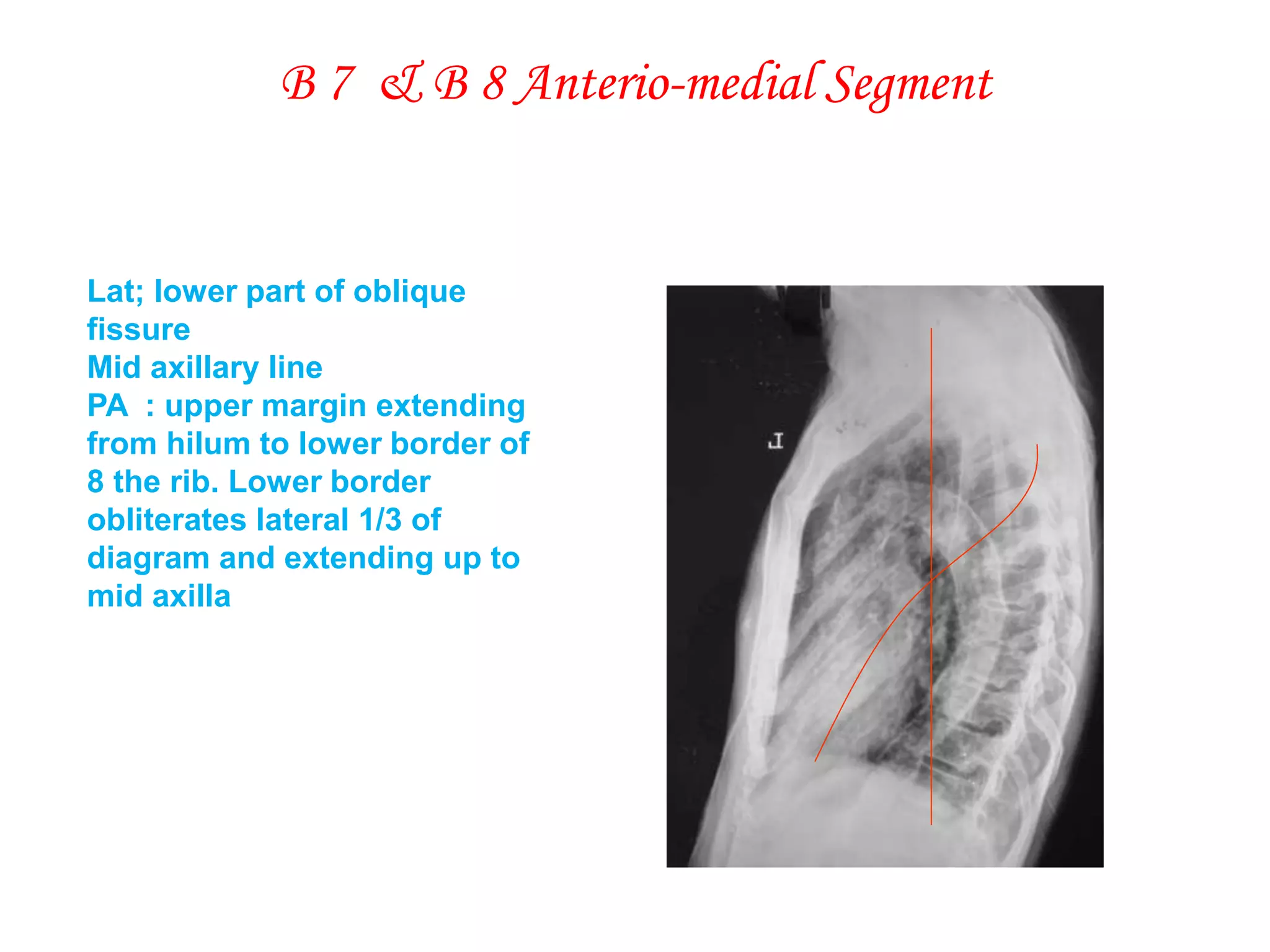 BRONCHOPULMONARY SEGMENTS OF THE LUNG | PPTX