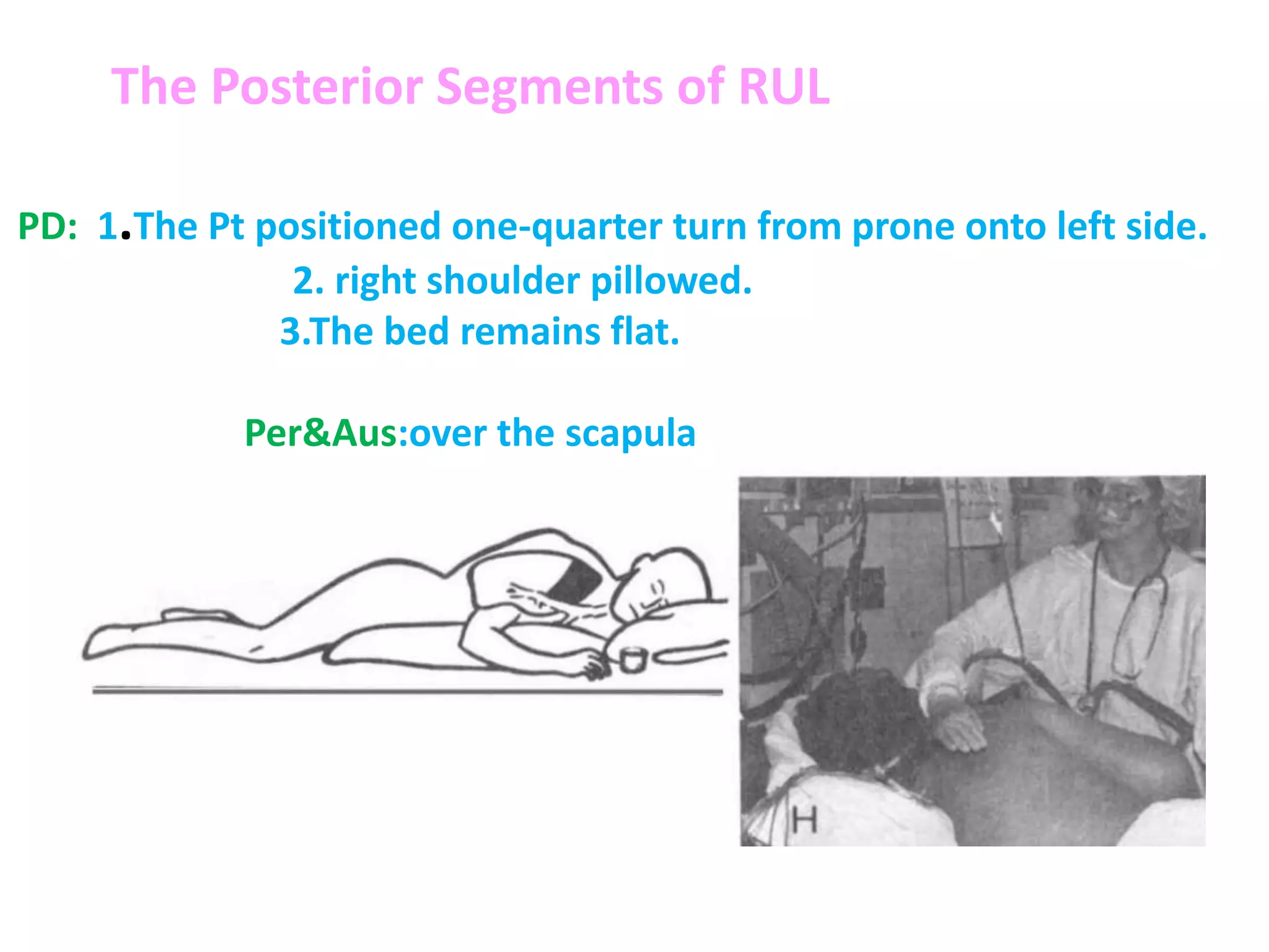 BRONCHOPULMONARY SEGMENTS OF THE LUNG | PPTX