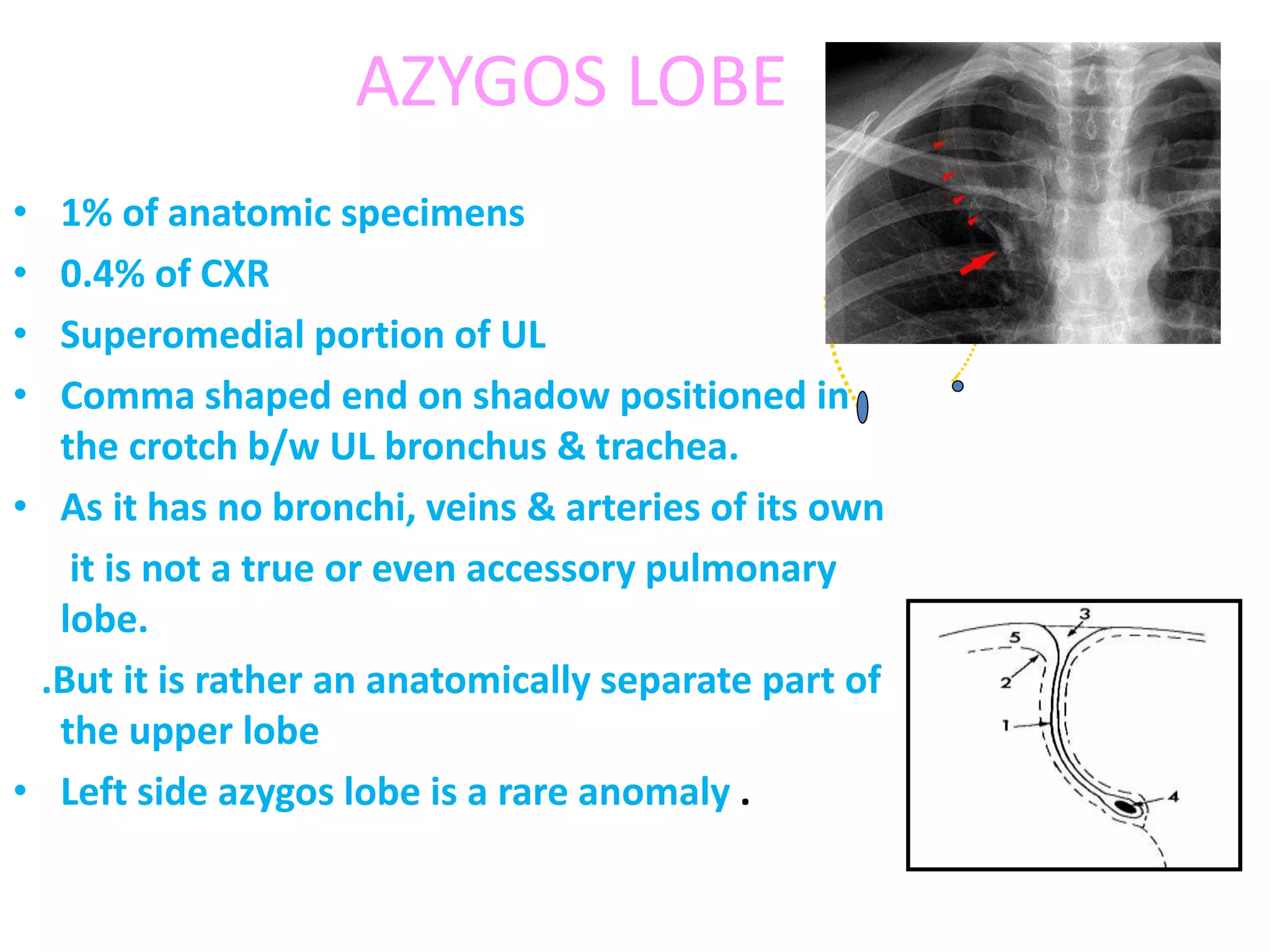 BRONCHOPULMONARY SEGMENTS OF THE LUNG | PPTX