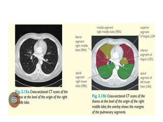 BRONCHOPULMONARY SEGMENTS OF THE LUNG | PPTX