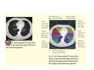 BRONCHOPULMONARY SEGMENTS OF THE LUNG | PPTX