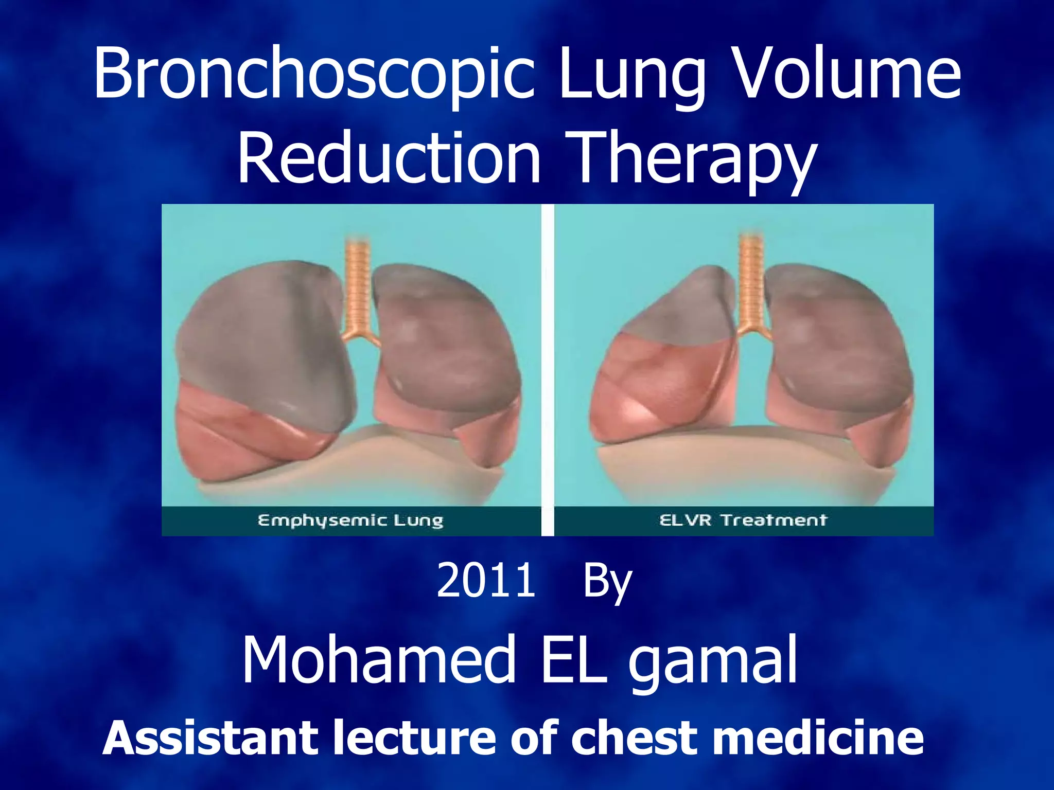 Bronchoscope lung volume reduction 2011 | PPT