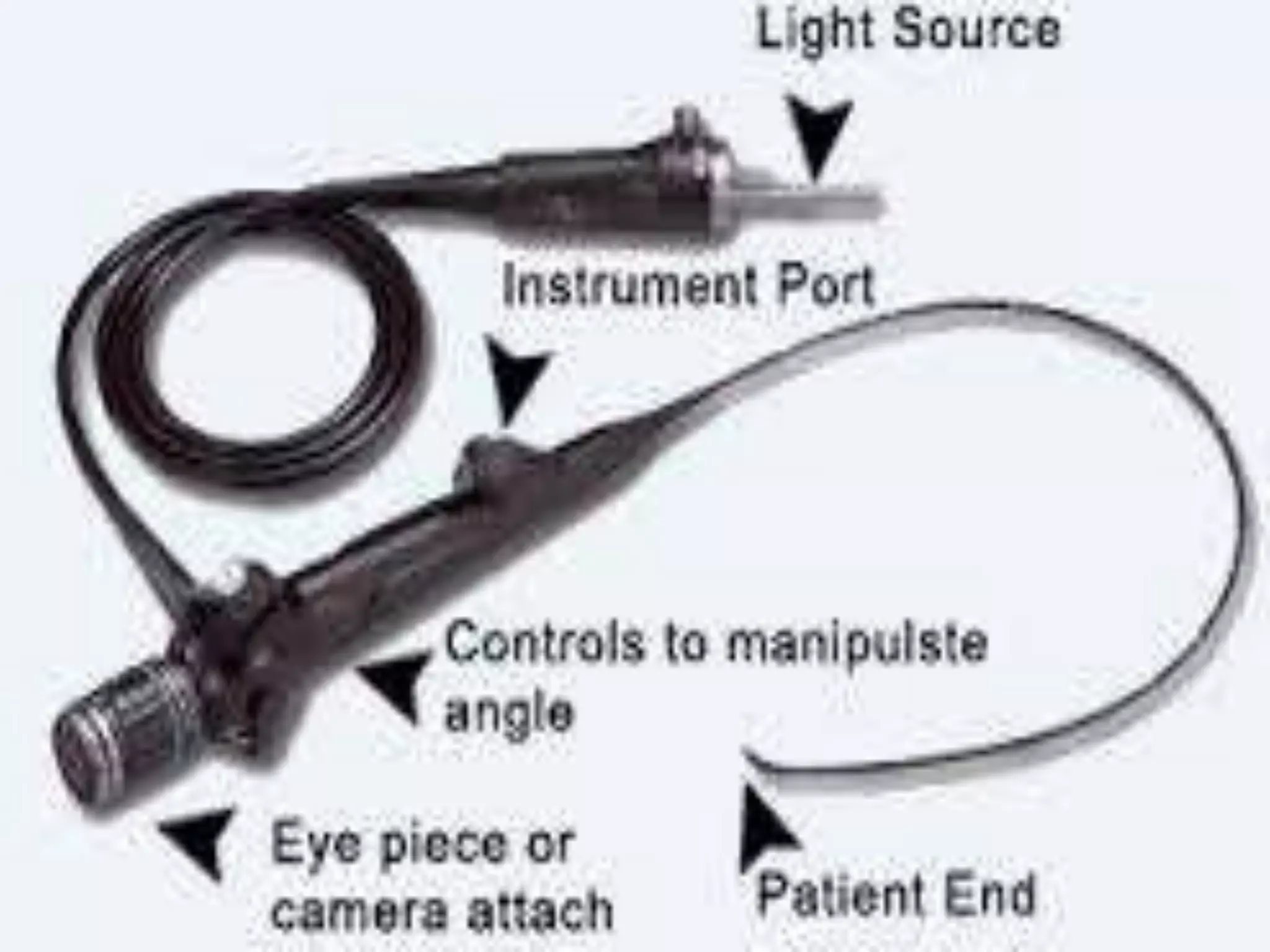 Bronchoscopy | PPTX